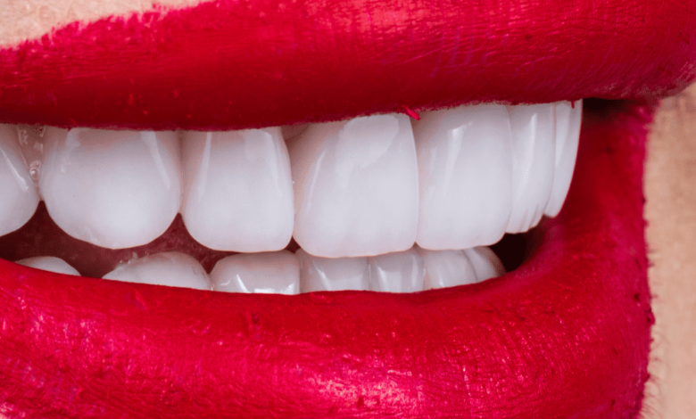 Unlocking Your Best Smile: A Guide to Smile Design and Enamel Reduction ...